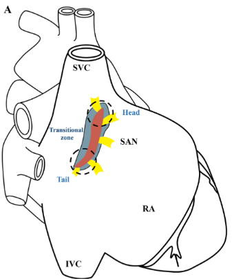 ECG Essentials