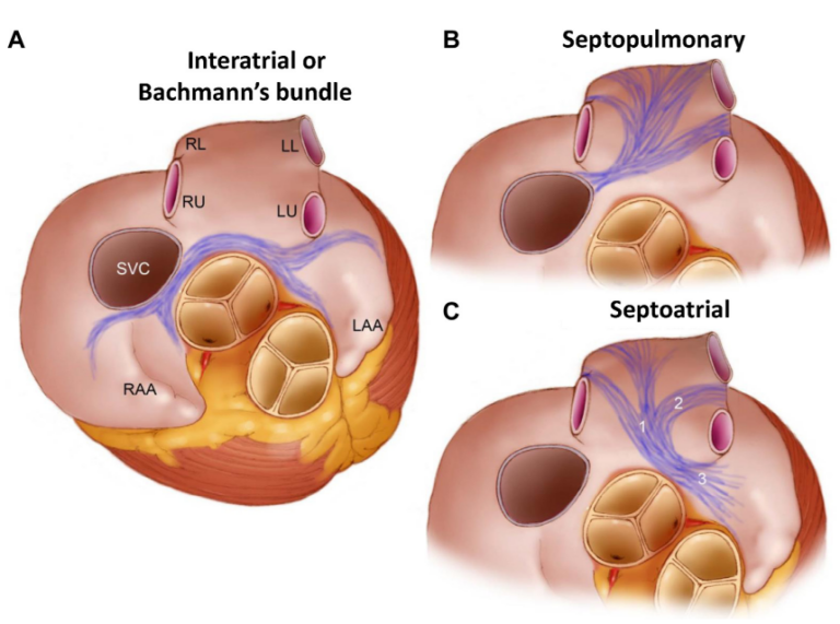ECG Essentials