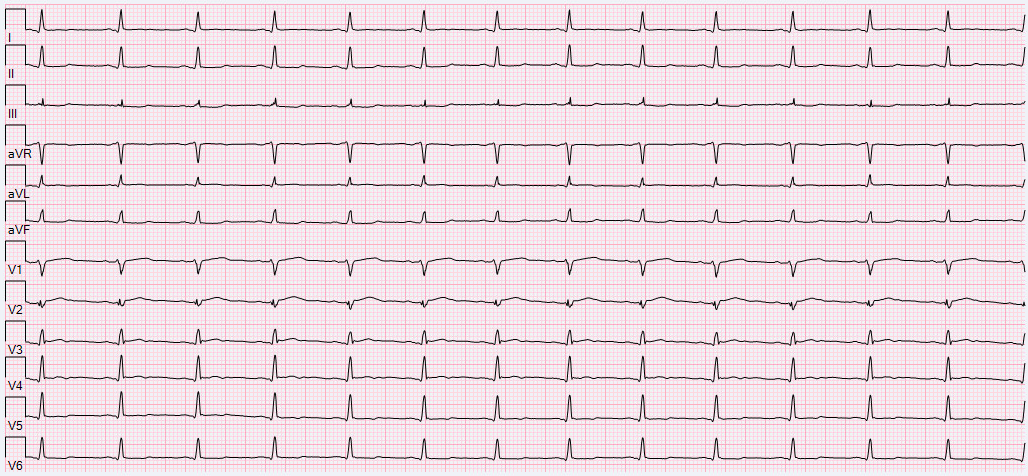 ECG Essentials