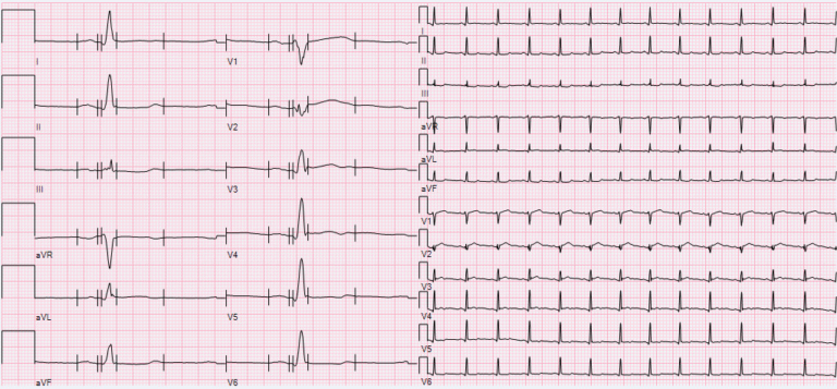 ECG Essentials